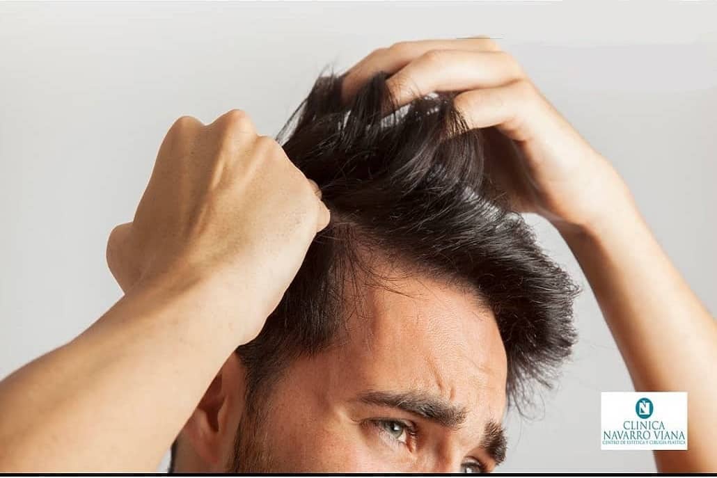 LAS 10 COSAS QUE DEBES SABER SOBRE LA CAÍDA DE PELO | Navarro Viana