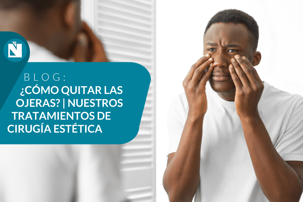 ¿Cómo Quitar Las Ojeras? | Navarro Viana