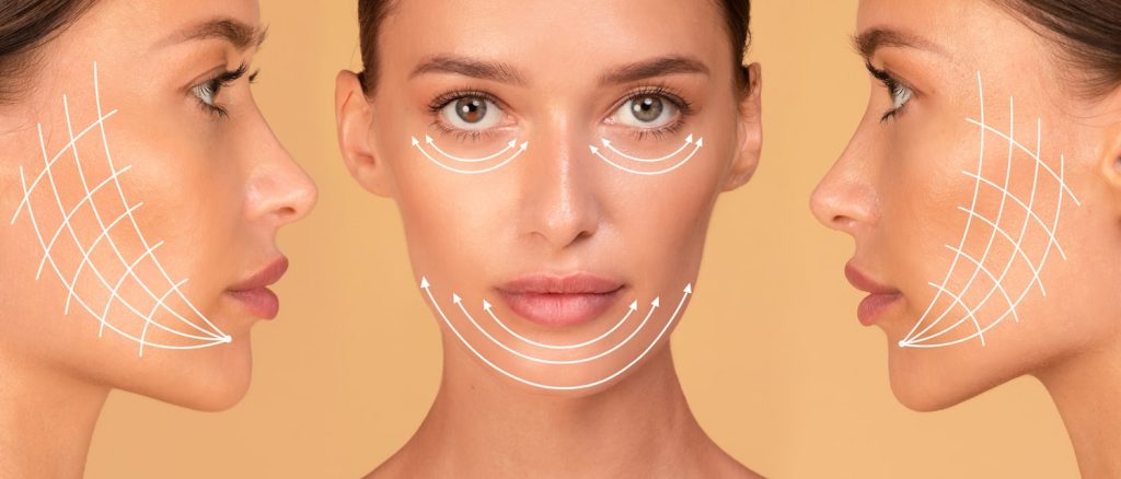 Hoy hablamos de... El Lifting Cervicofacial (cara y cuello) | Navarro Viana